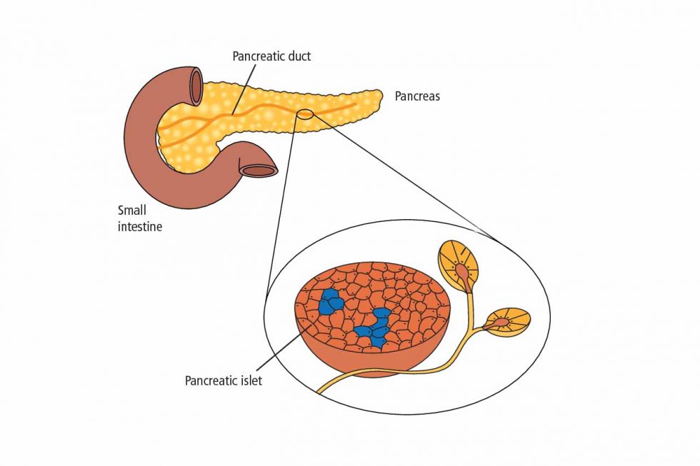 Soal Pankreas & Diabetes Mellitus - apa yang anda perlu tau